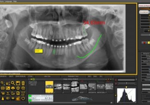 Mediadent V8 - Multi-user | Dental Discovery
